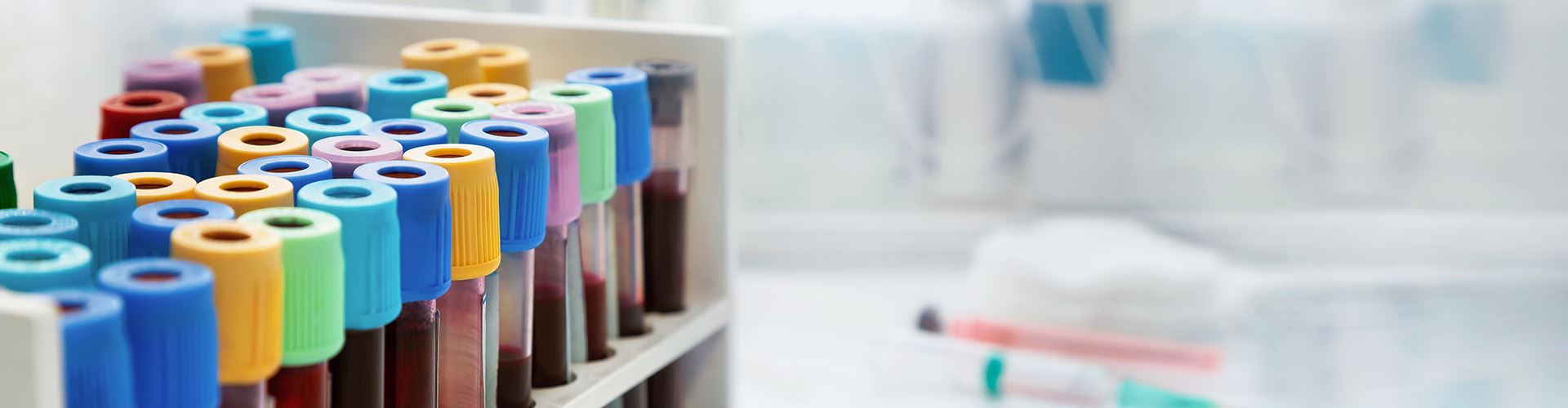 Laboratory Services | Kahuku Medical Center